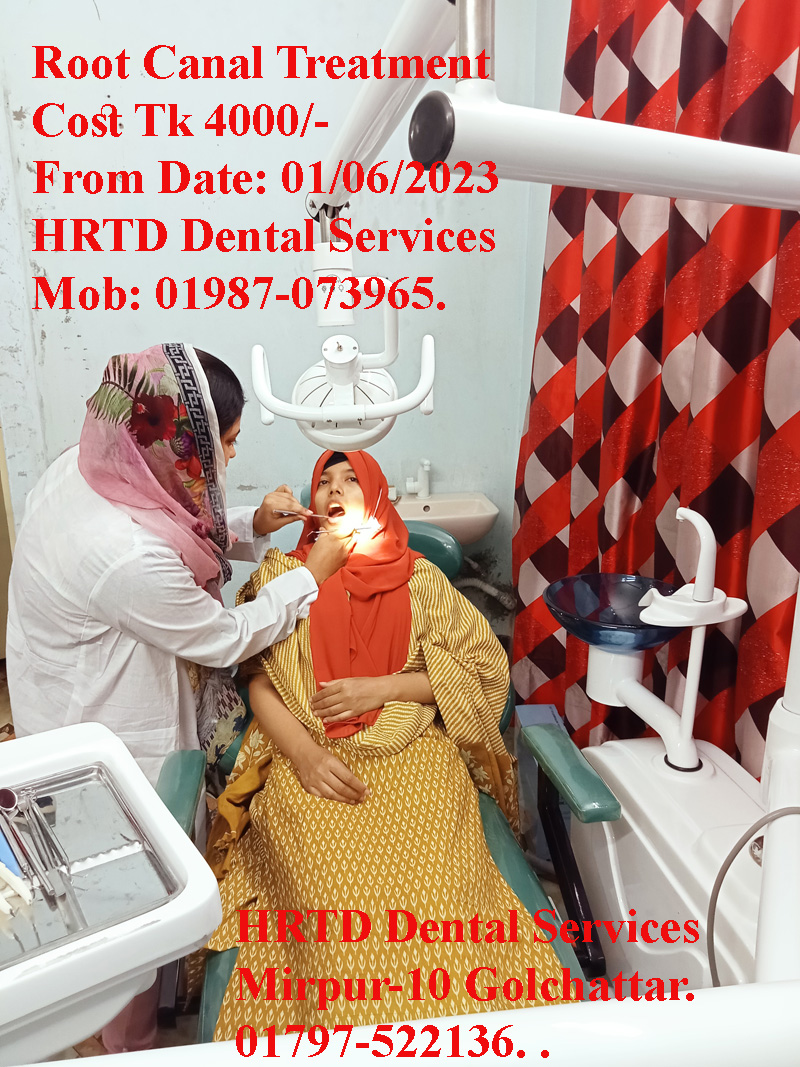 Best Root Canal Treatment Cost in Mirpur, Dhaka. Mob 01797-522136